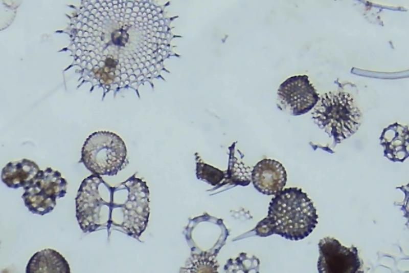 Radiolarians Under Microscope