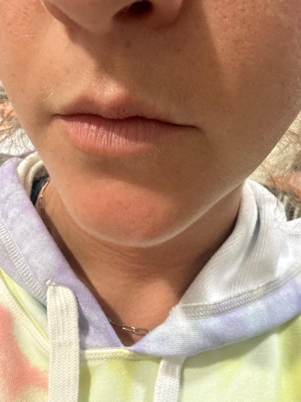 Chapstick Spf 15 Lip Balm Stick- Hydrating and Sun Protection For Your ...