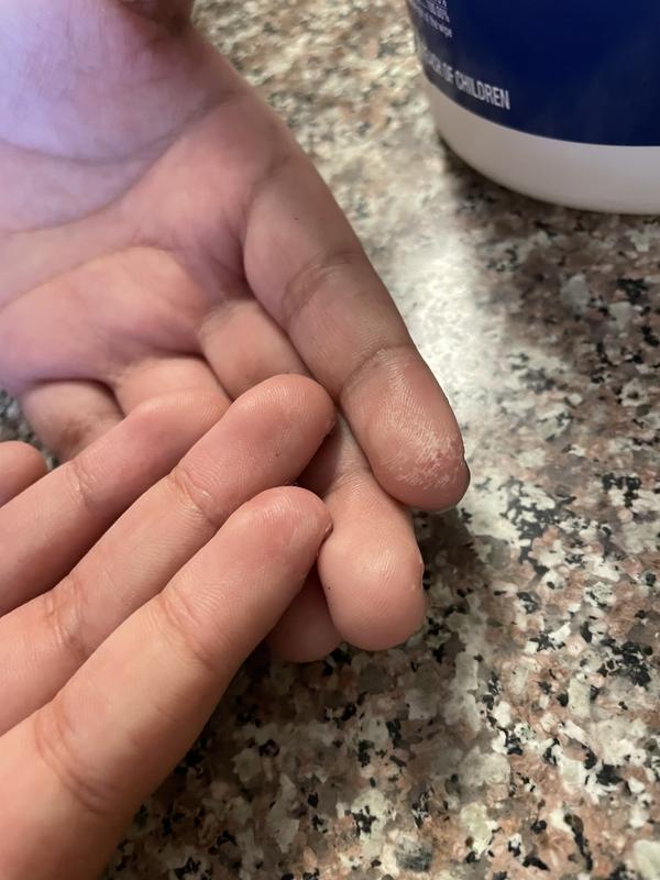 Dawn 75-Count Fresh Scent Disinfectant Wipes All-Purpose Cleaner (3 ...