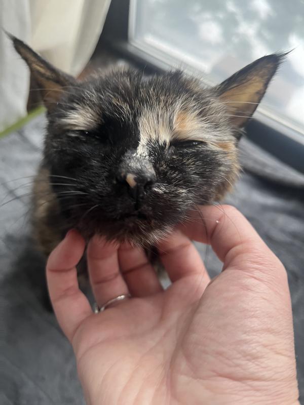 BAXTER Solution Set with Duo Vent Spike (Y-Injection) 104-in, 10 Drops ...