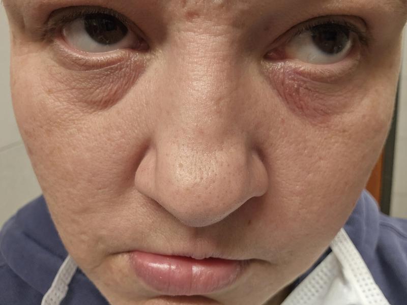 Peter Thomas Roth Instant FIRMx® Eye Temporary Eye Tightener, 1.0 fl ...