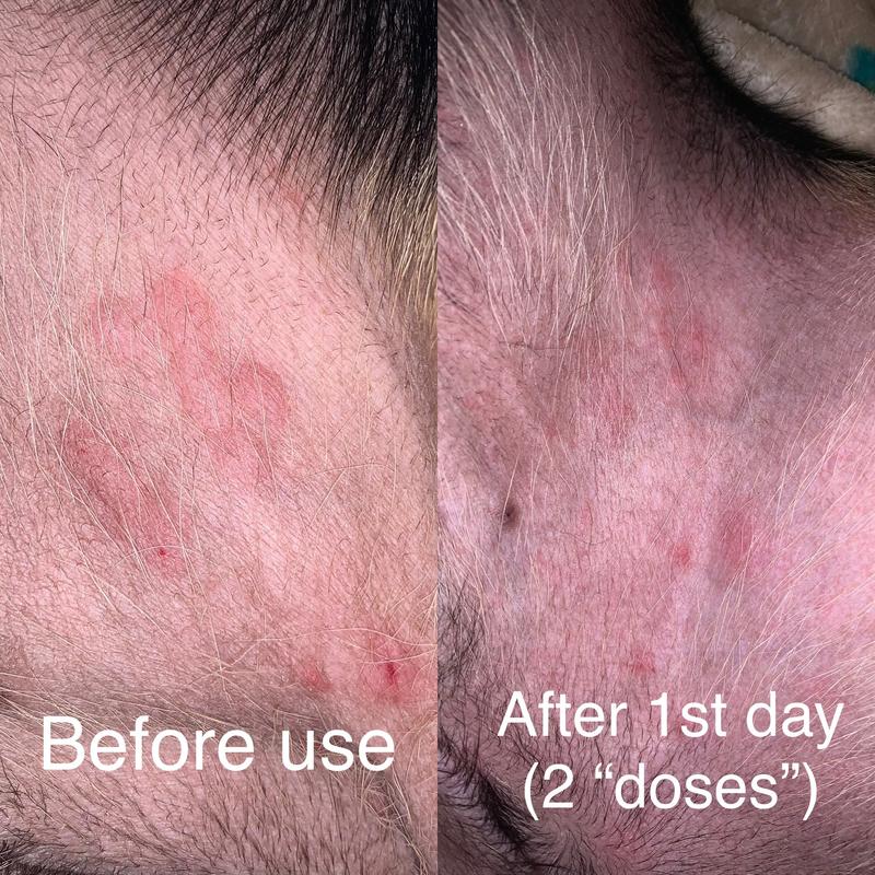 Veterinary Formula Antiseptic and Antifungal Medicated Pet Spray, 8 oz ...