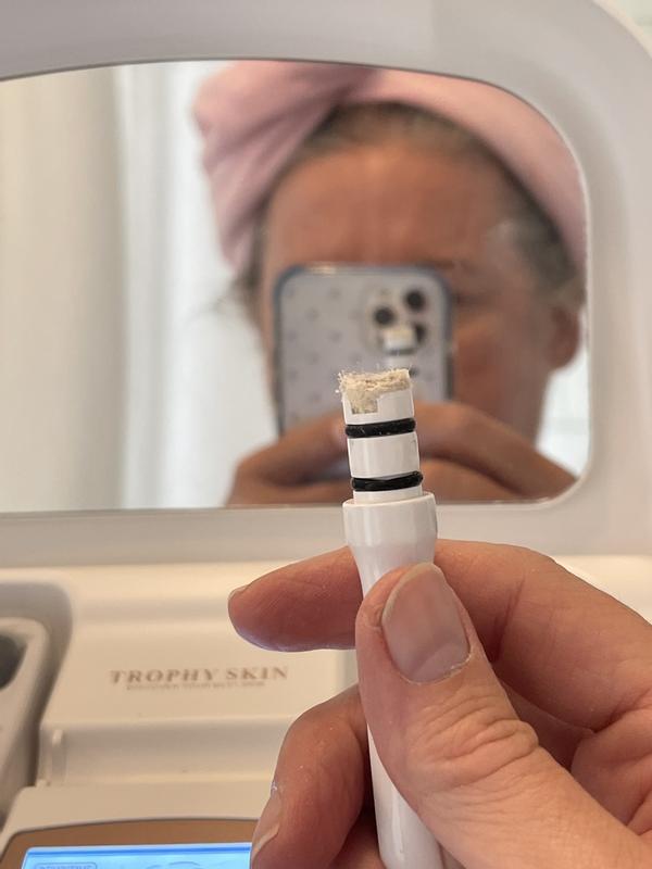 Trophy Skin Precision Diamond Tip - Trophy Skin Microdermabrasion - Macy's